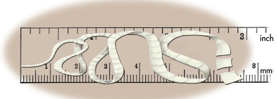 When, Why and How to Deworm Chickens - Backyard Poultry